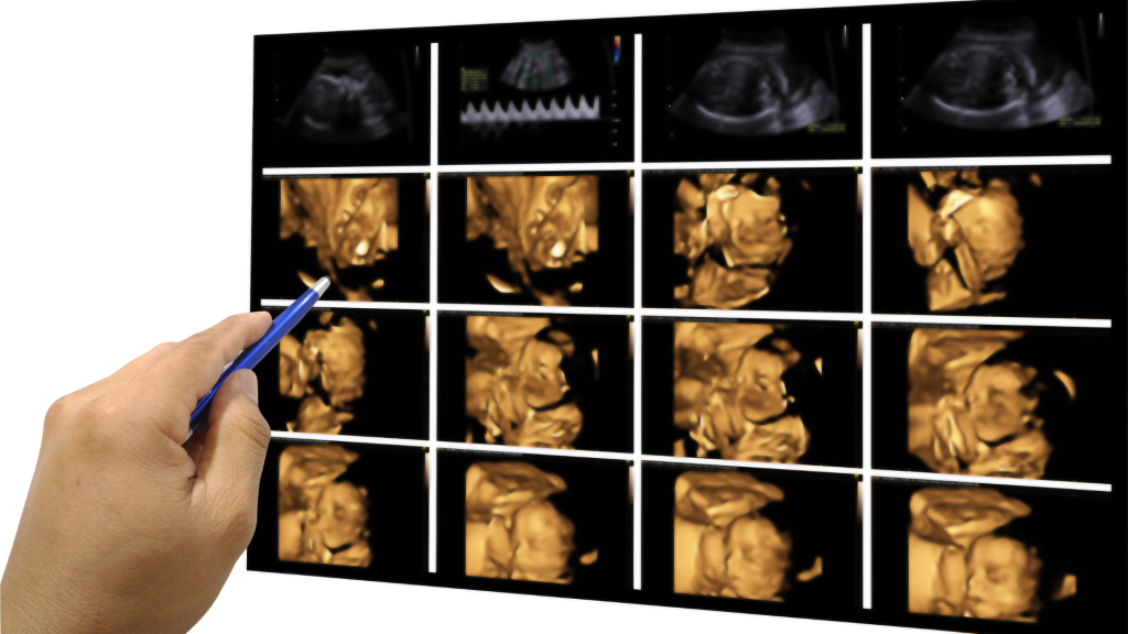 What Is a 3D Ultrasound and How It Works | Expert Guide